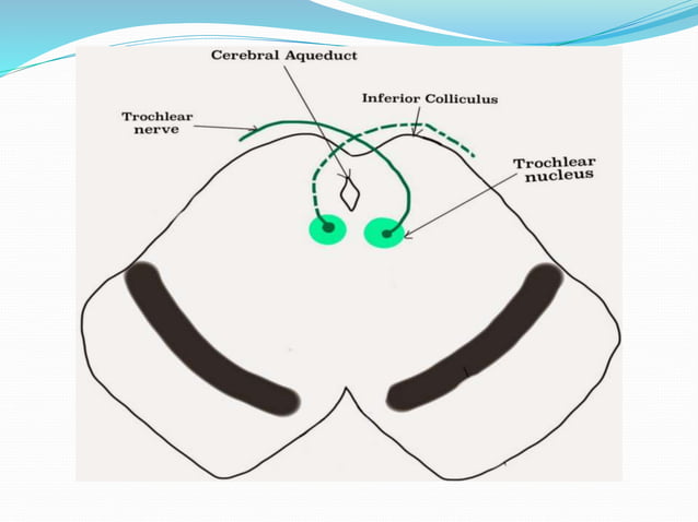 Cranial nerve iv and vi | PPT