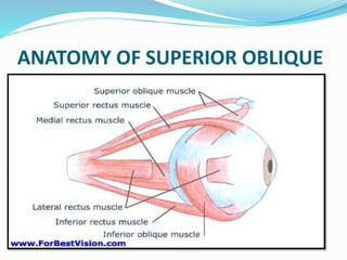 Cranial nerve iv and vi | PPTX
