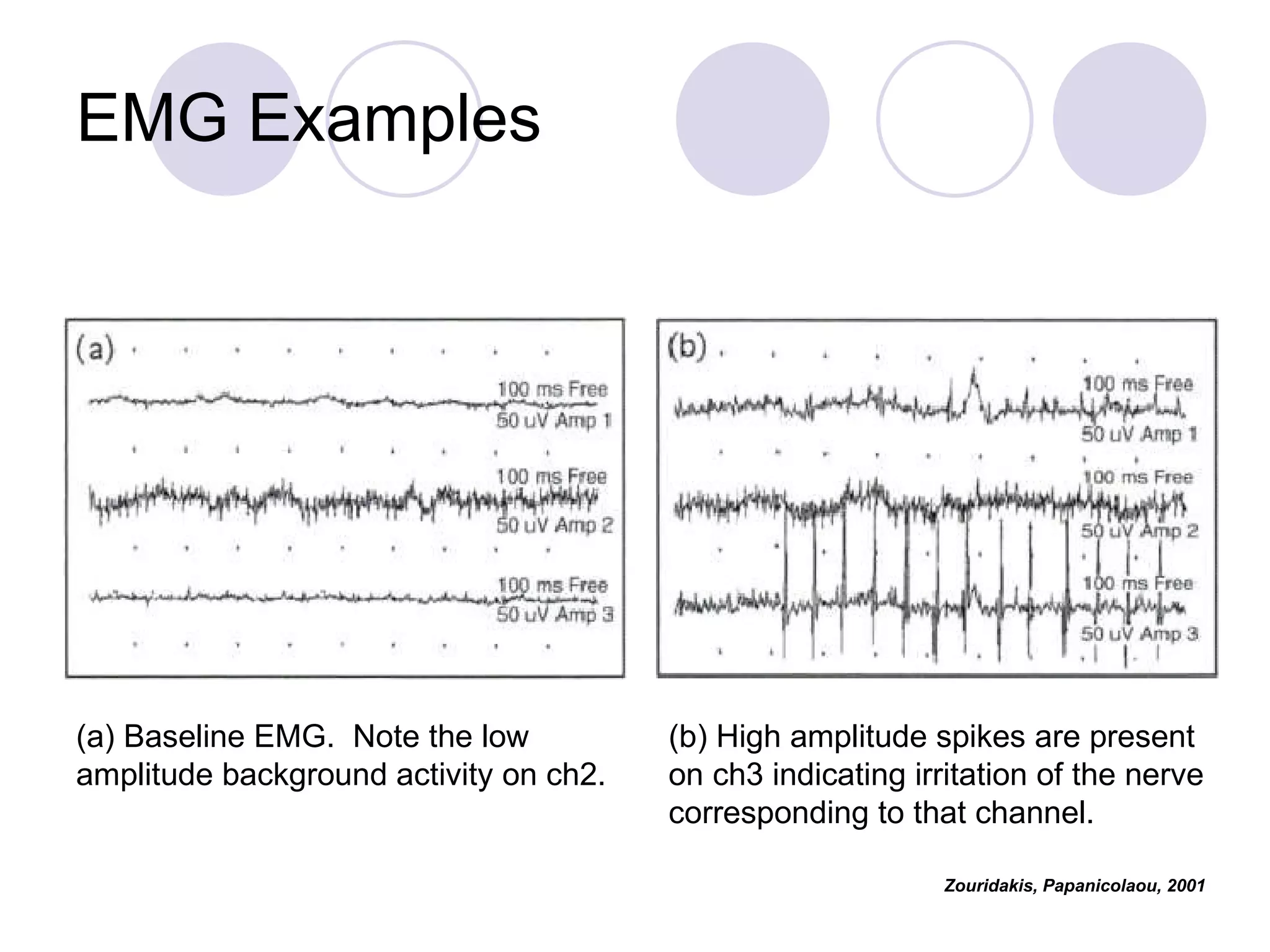 Cranial Nerve Monitoring | PPT