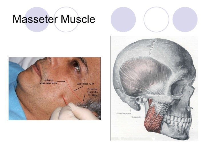 Cranial Nerve Monitoring
