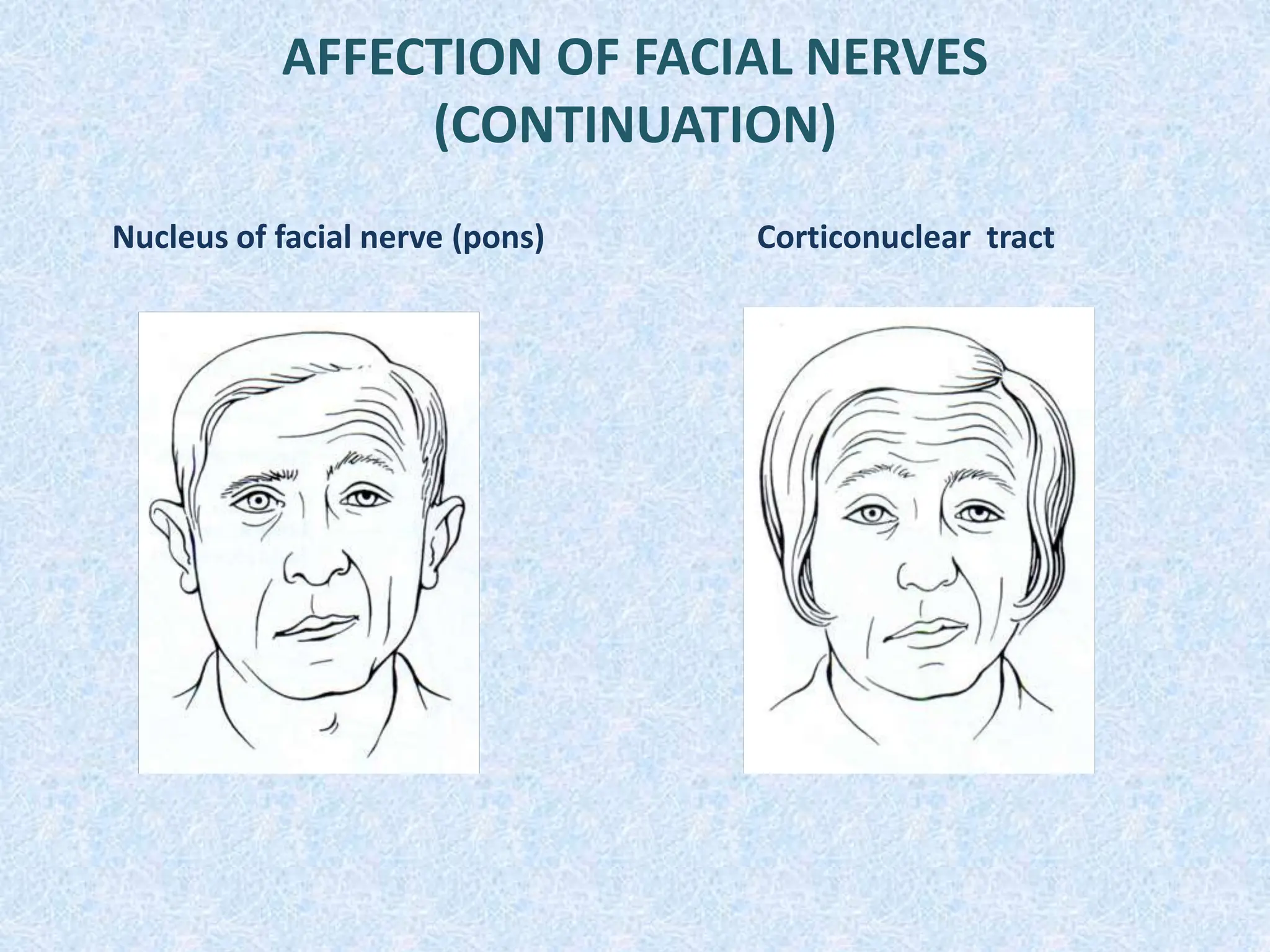 cranial nerves .ppt