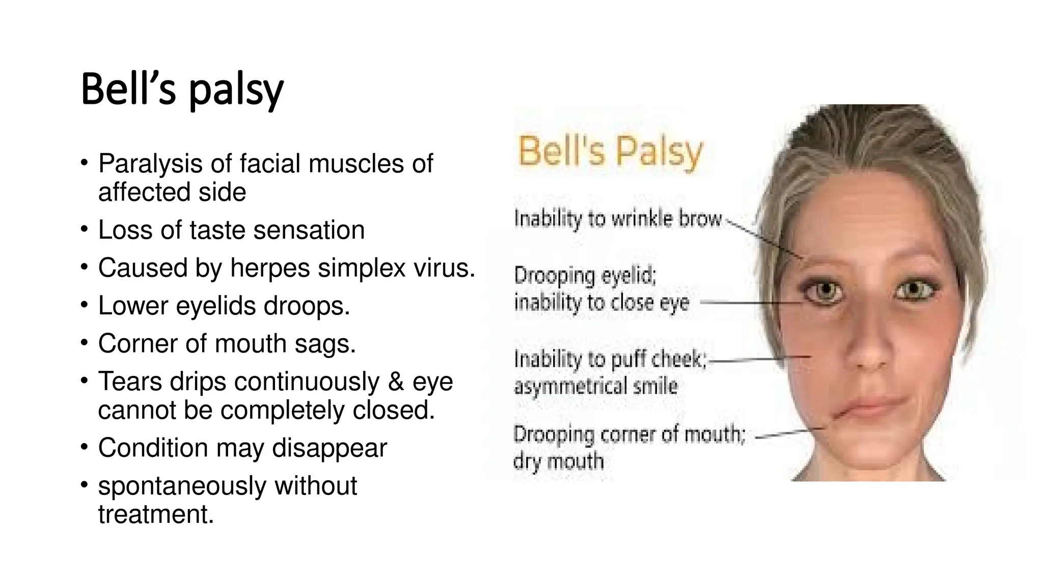 cranial nerves presentation by Dr Ela kinra | PPTX