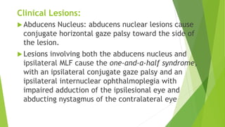 3rd, 4th and 6th Cranial nerves | PPTX