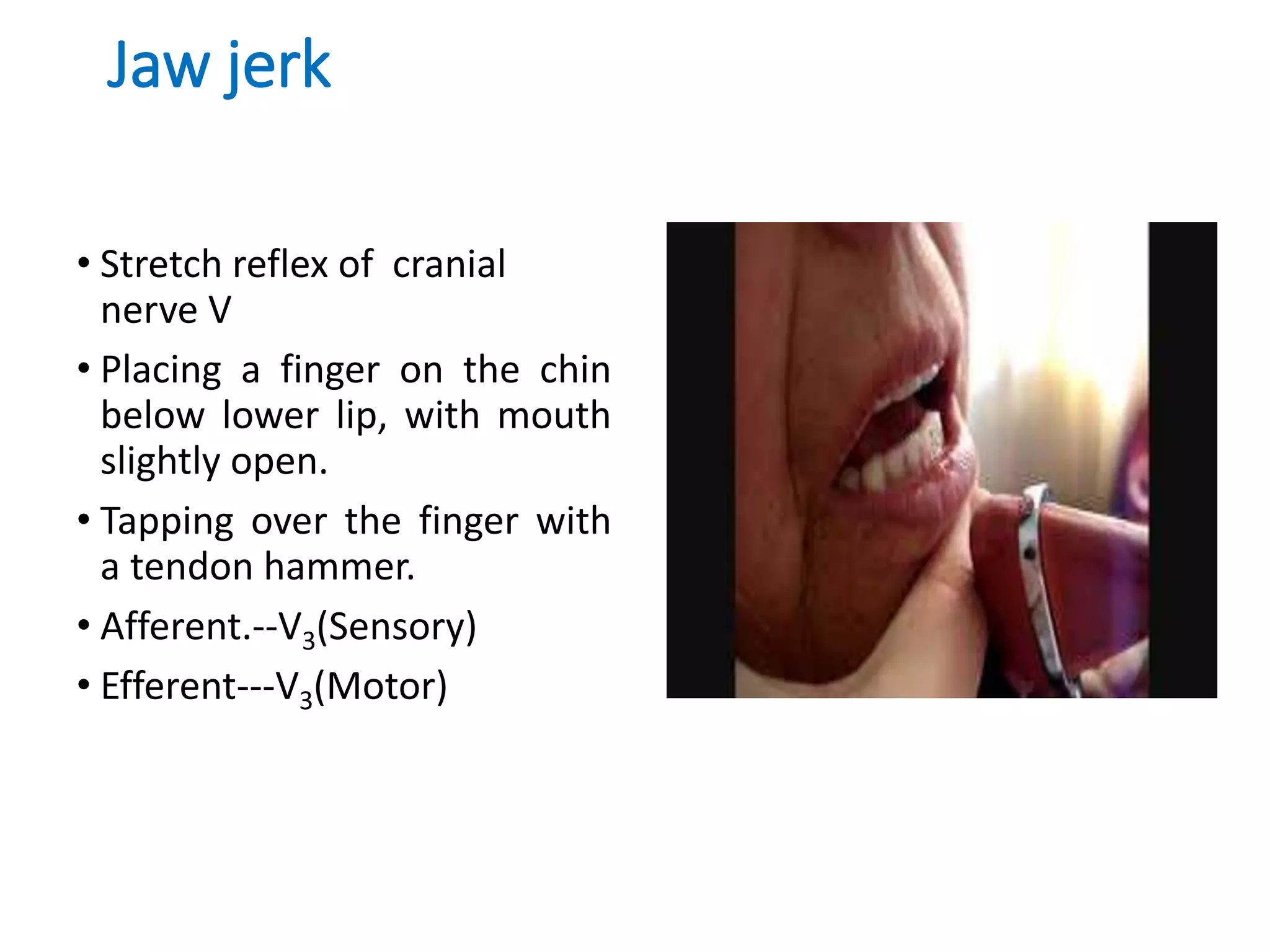 Cranial Nerves 5,7,8.ppt