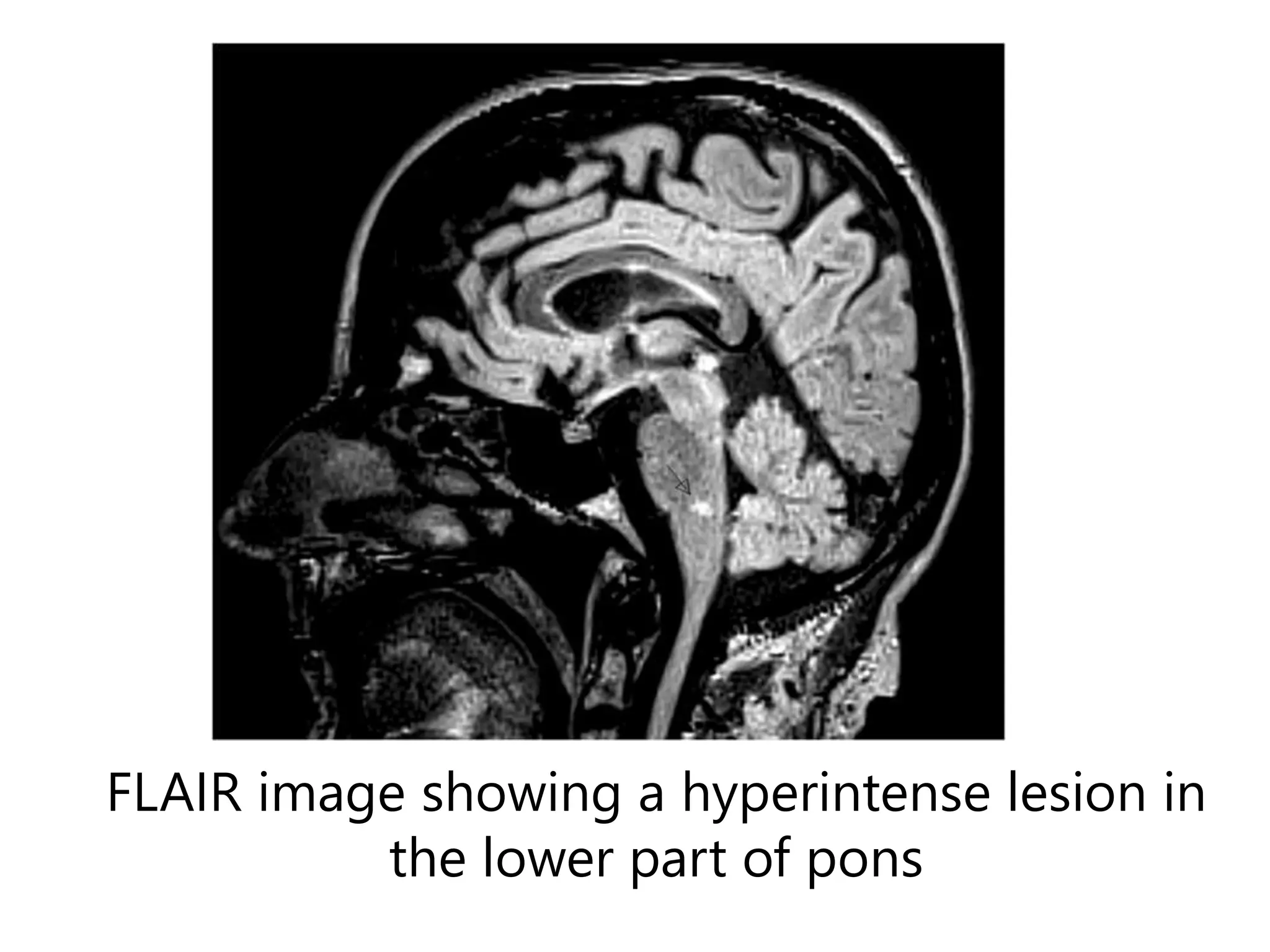 Cranial Nerves 5,7,8.ppt