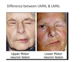 Cranial Nerves 5,7,8.ppt