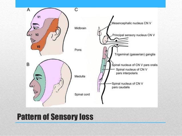 Diseases of Cranial nerves 5th, 7th and 8th