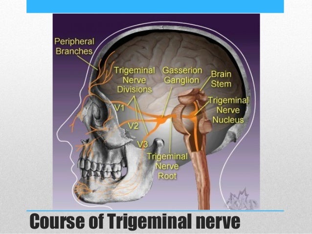 Diseases of Cranial nerves 5th, 7th and 8th