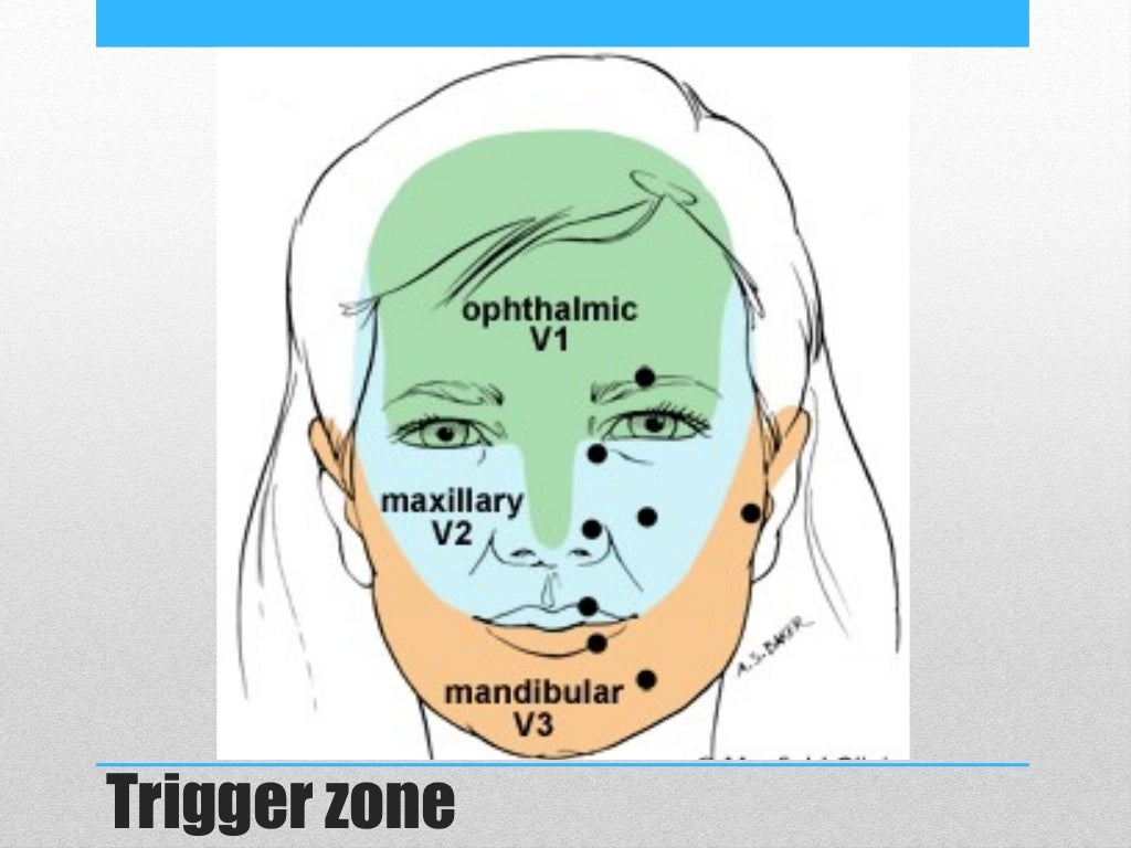 Cranial Nerve Tumors Symptoms