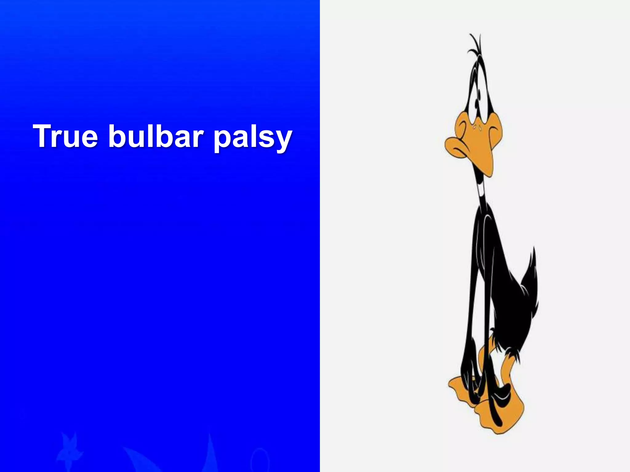 Bulbar Cranial nerves (9-10-11-12) - bulbar palsy - Walid Reda Ashour ...