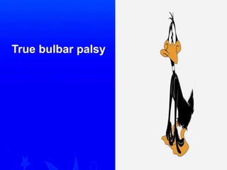 Bulbar Cranial nerves (9-10-11-12) - bulbar palsy - Walid Reda Ashour ...