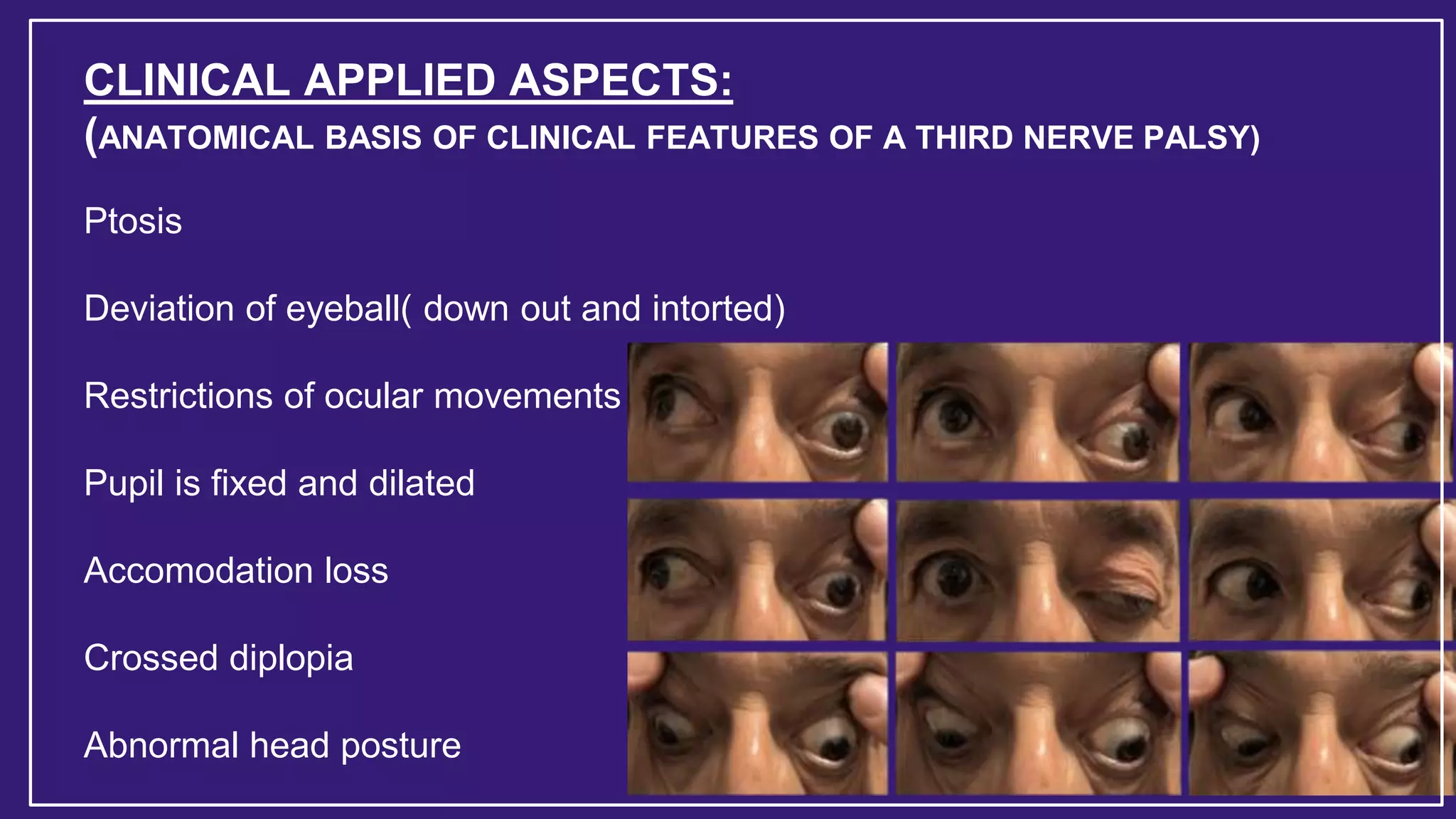 Cranial nerves | PPTX