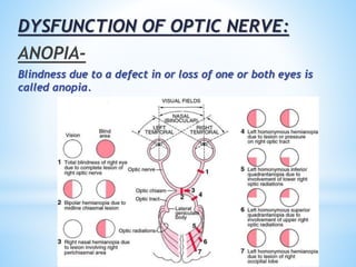 Cranial nerves functions and dysfunctions.pptx