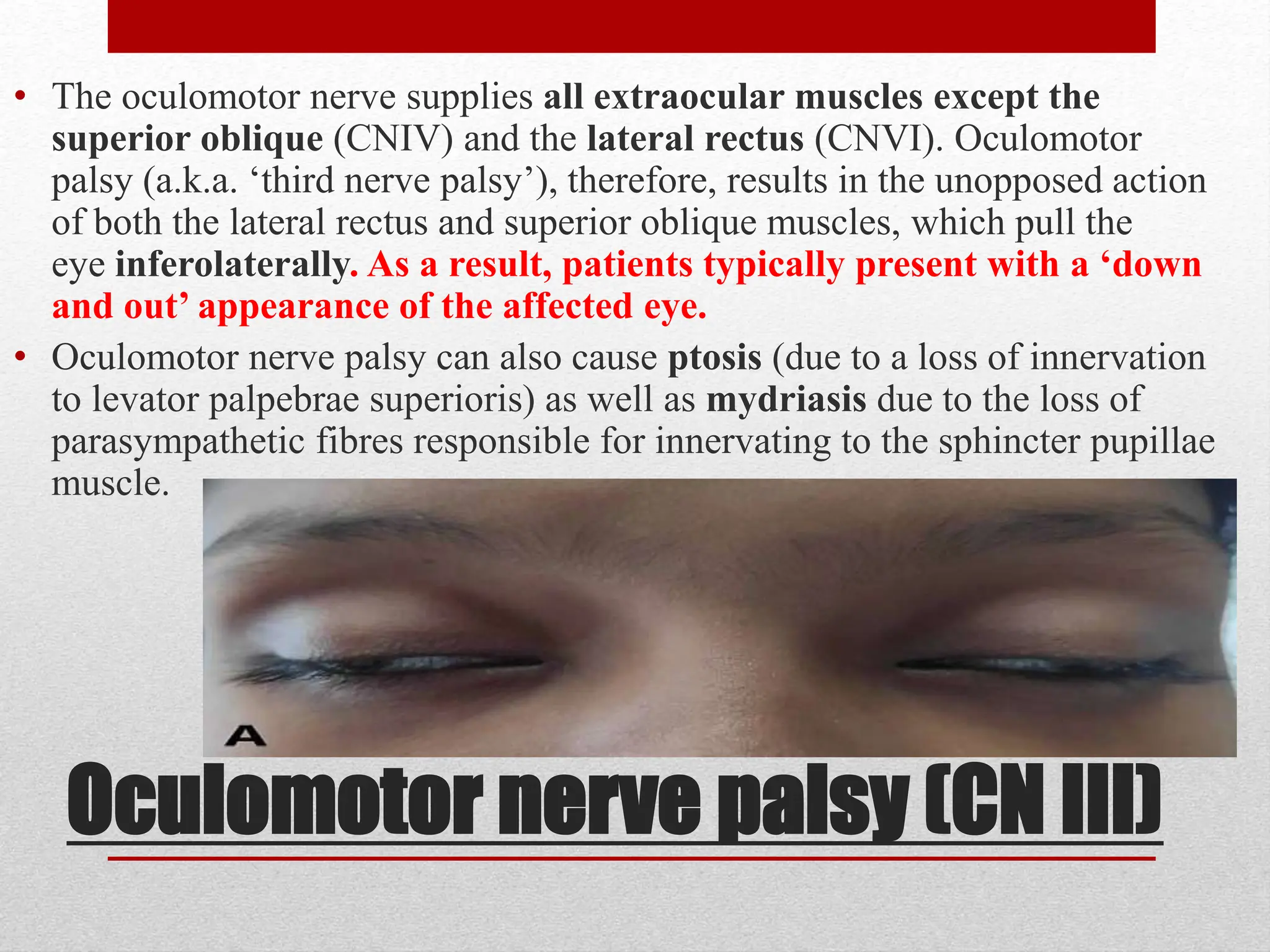 Cranial_Nerves_examination Cranial nerve examination frequently appears ...