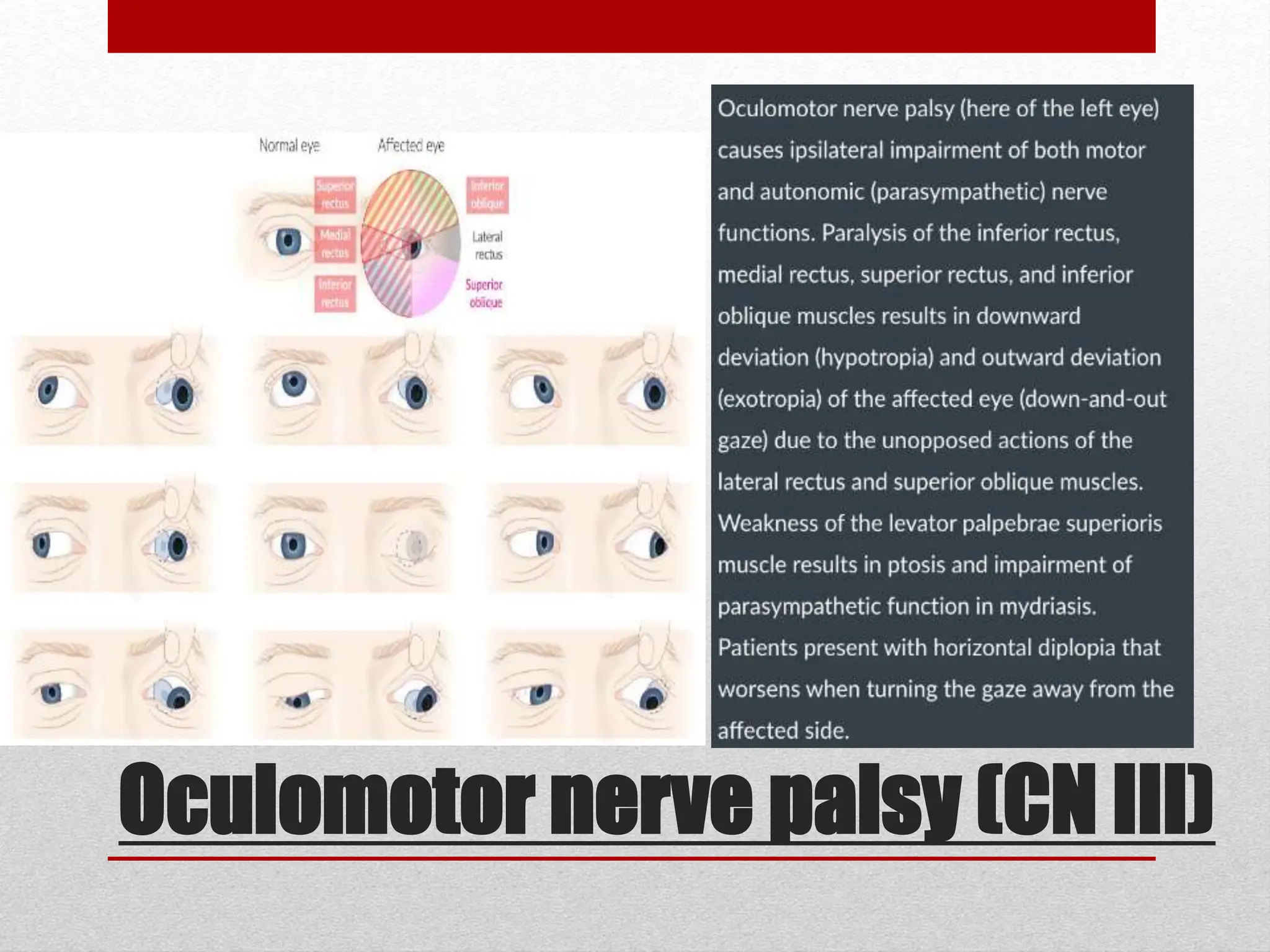 Cranial_Nerves_examination Cranial nerve examination frequently appears ...