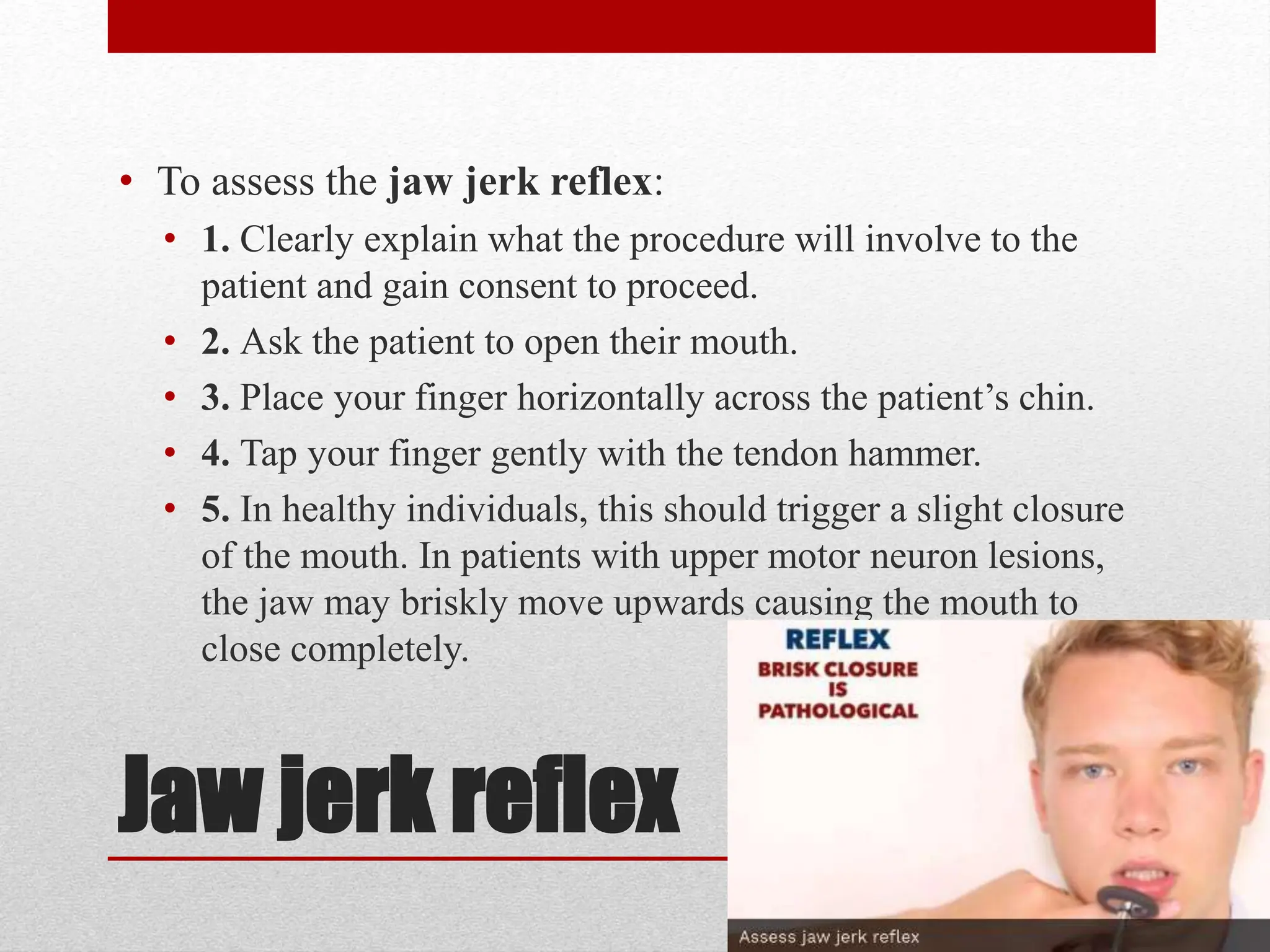 Cranial_Nerves_examination Cranial nerve examination frequently appears ...