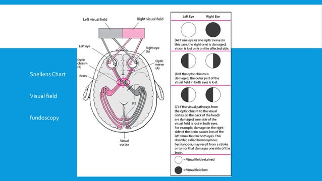 Cranial Nerves | PDF | Death, Injury, or Military Conflict | Sensitive ...