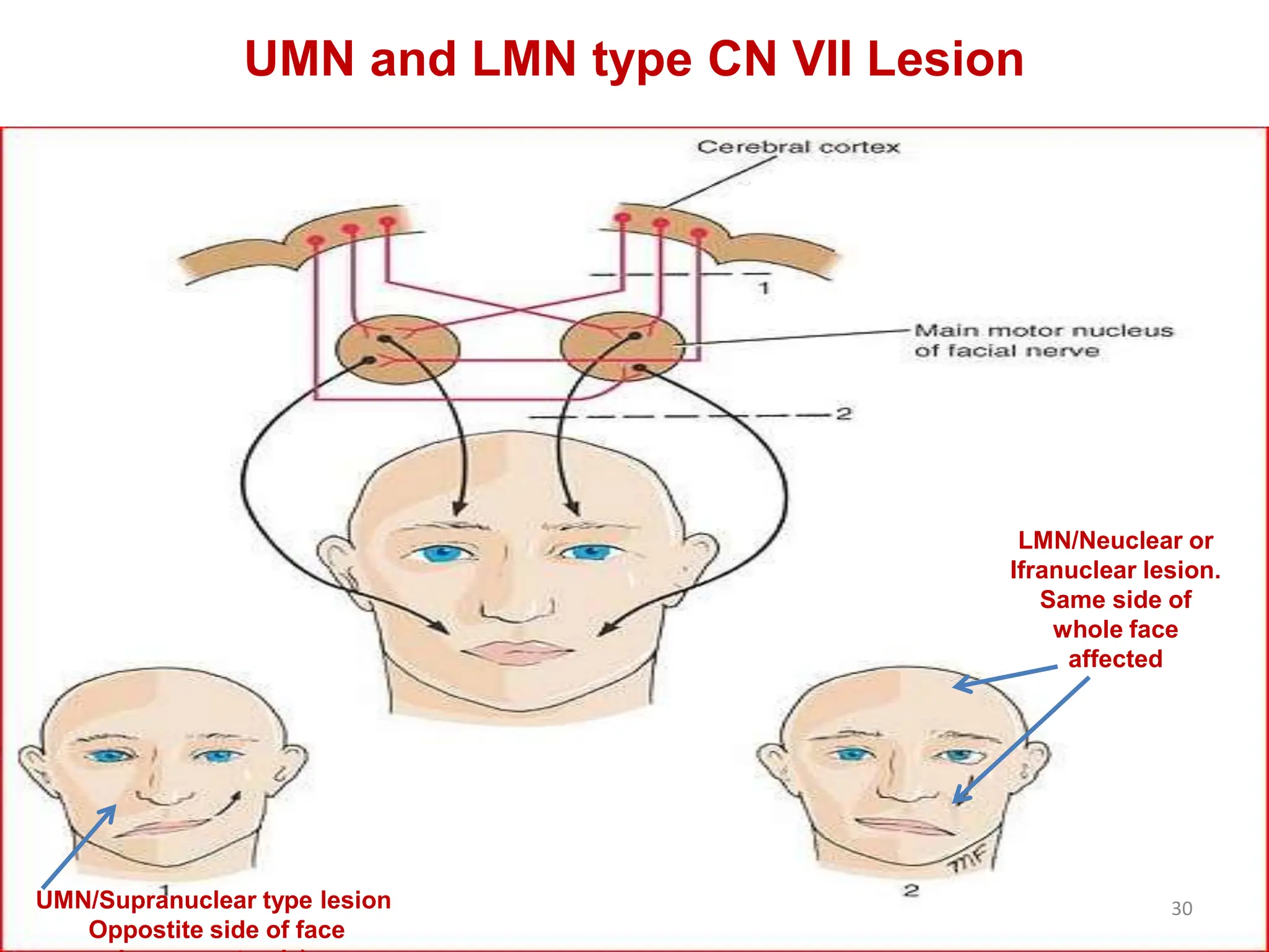 Cranial nerves VII & VIII applied and anatomy.pptx