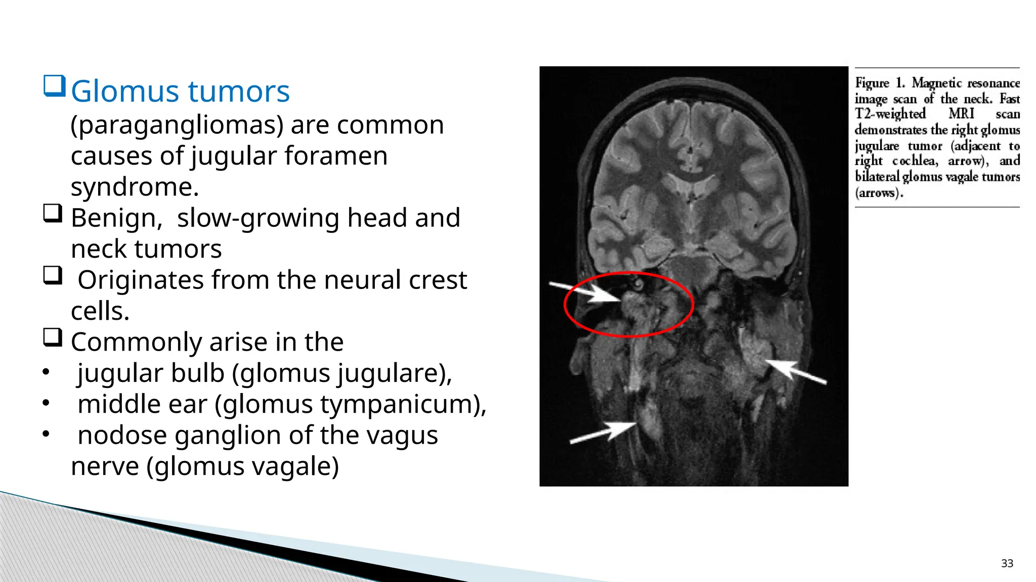 Examination of lower cranial nervesCRANIAL NERVES (XI,XII) | PPTX