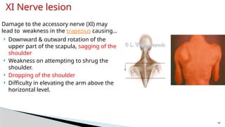Examination of lower cranial nervesCRANIAL NERVES (XI,XII) | PPTX