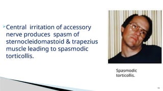 Examination of lower cranial nervesCRANIAL NERVES (XI,XII) | PPTX