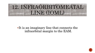 CRANIAL POSITIONING LINES & LANDMARKS.pptx