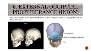 CRANIAL POSITIONING LINES & LANDMARKS.pptx