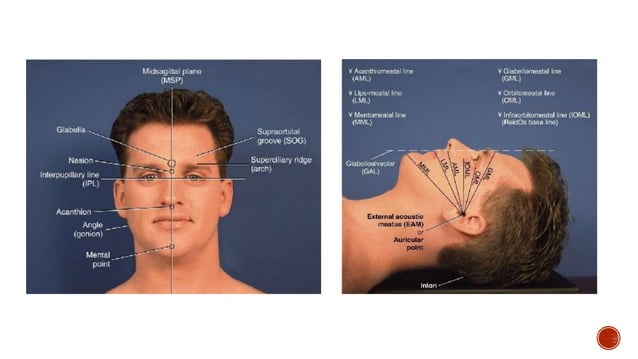 CRANIAL POSITIONING LINES & LANDMARKS.pptx