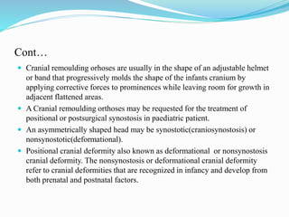 Cranial remodelling orthosis | PPTX