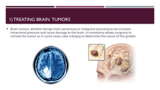 Cranial surgery.It's techniques intervention pptx | PPTX