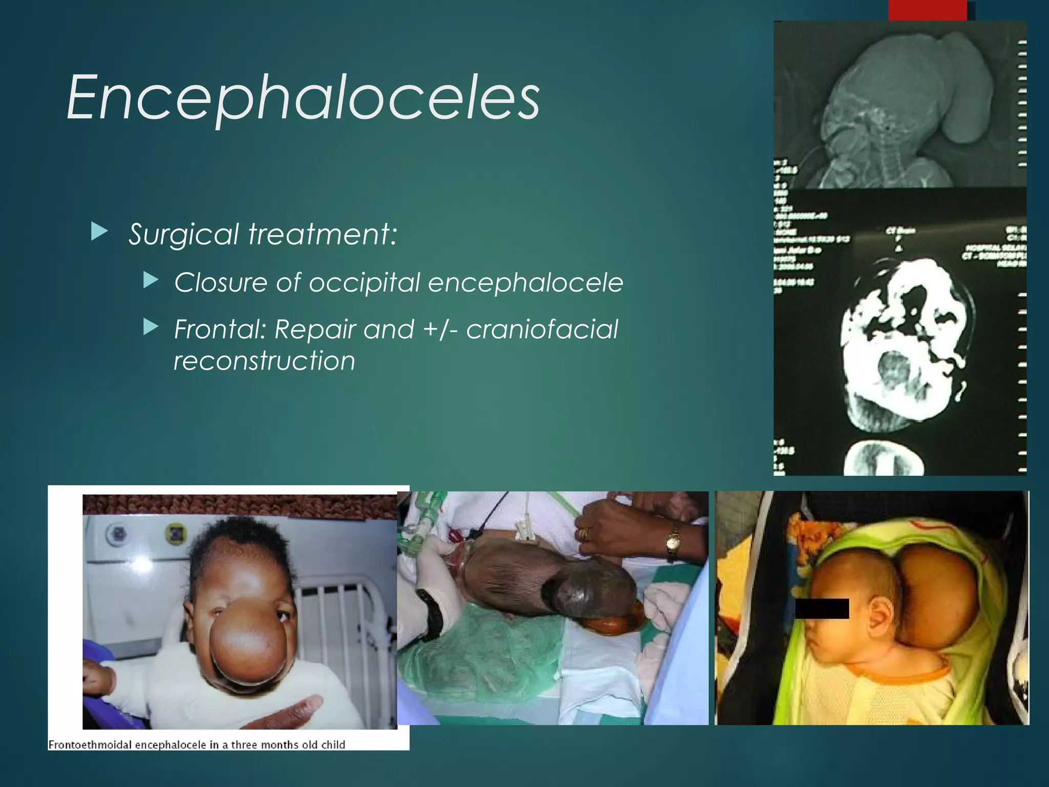 Cranial Surgery | PPT