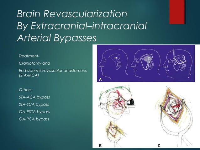Cranial Surgery | PPT | Brain and Nervous System Disorders | Diseases ...