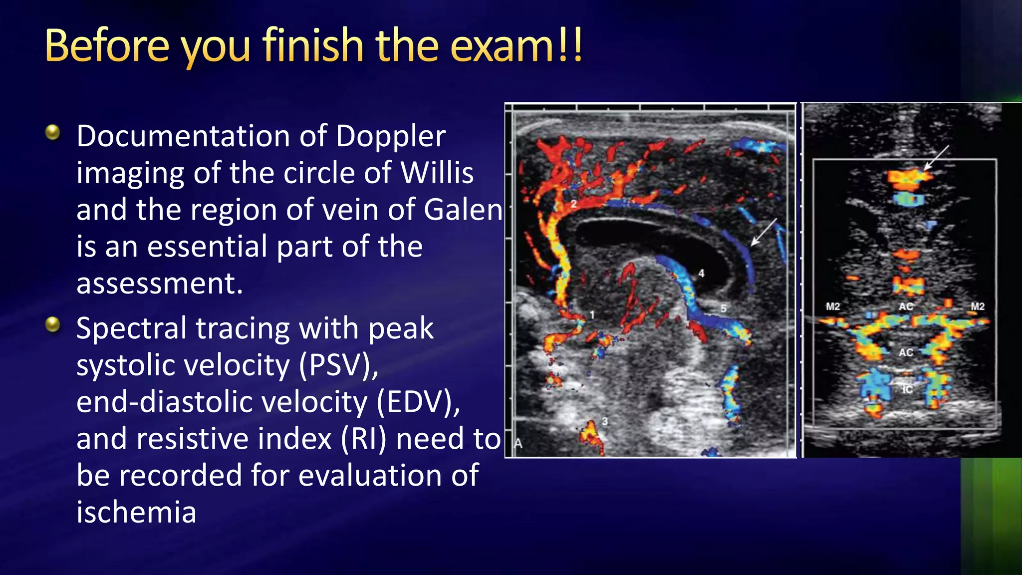TRANSCRANIAL ULTRASOUND | PPTX