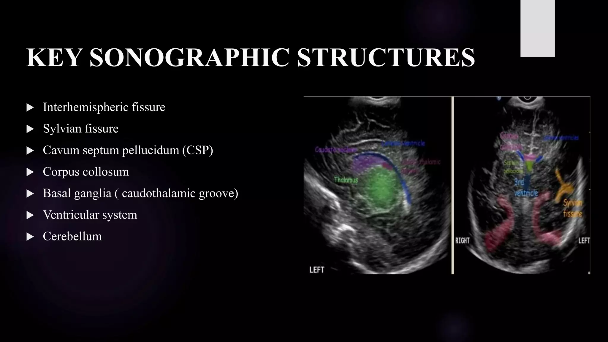 Cranial usg final.pptx