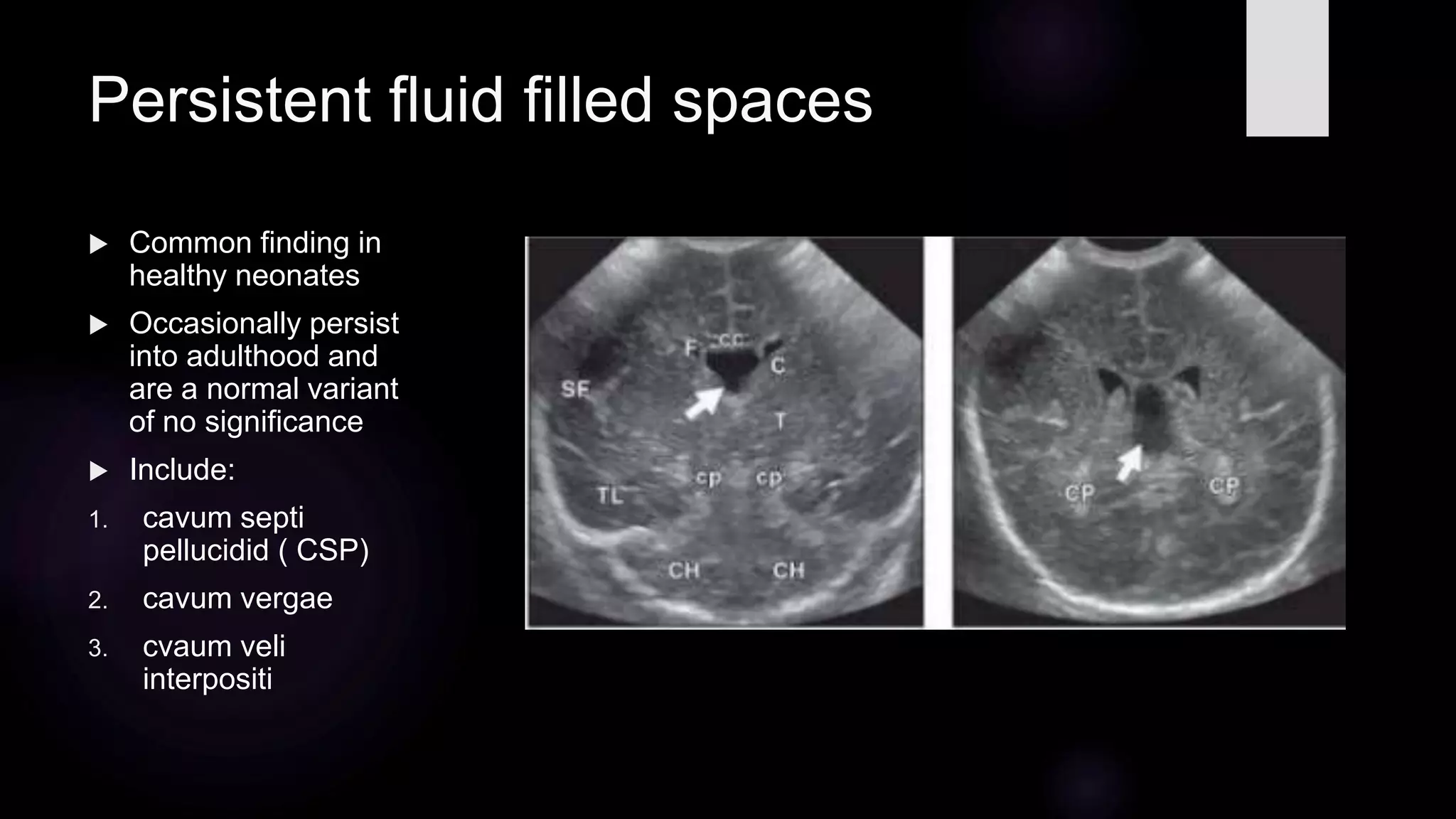 Cranial usg final.pptx | First Aid | Injuries