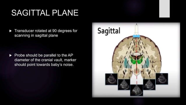 Cranial usg final.pptx | First Aid | Injuries