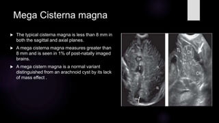 Cranial usg final.pptx