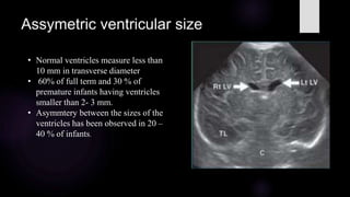Cranial usg final.pptx