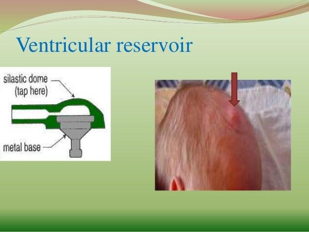 Cranial ultrasnography, by dr Rabab hashem