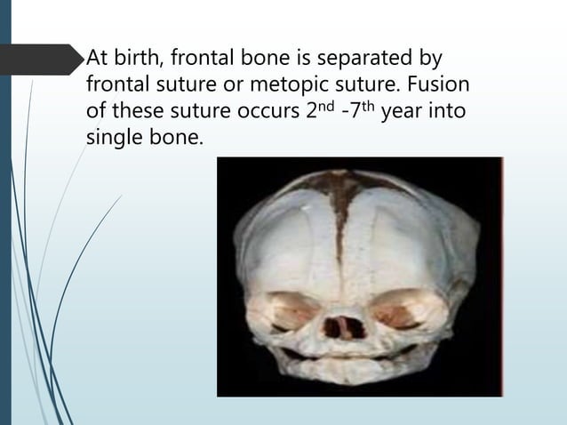 Cranial vault | PPTX