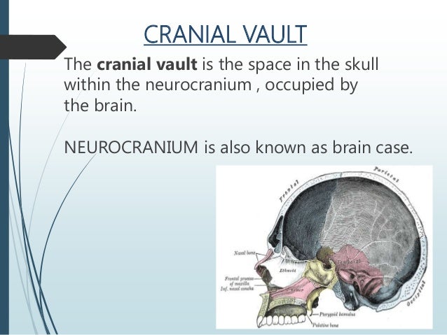 Cranial vault