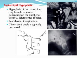 Cranio vertebral anomalies- overview - | PPTX