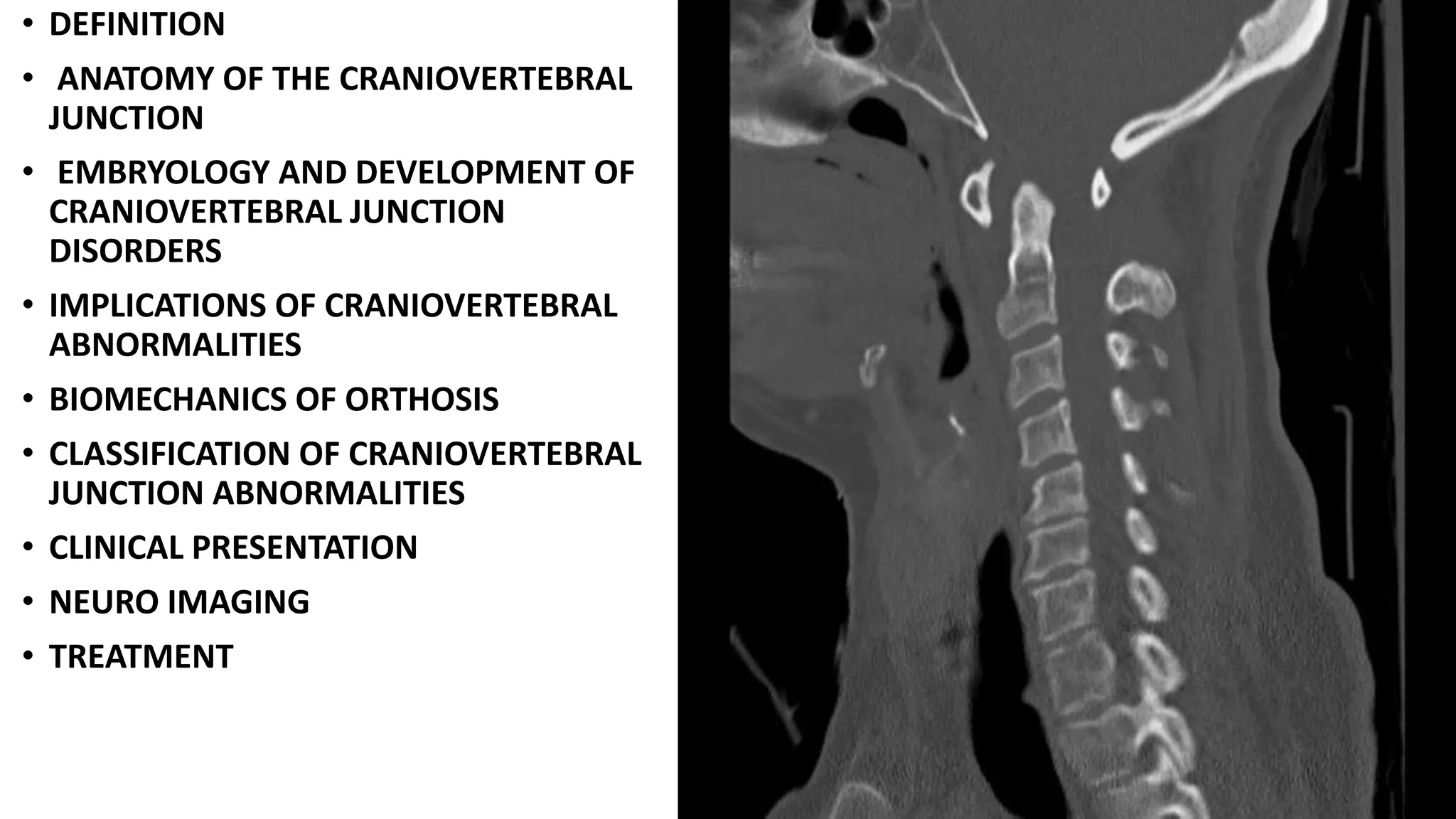 Cranio vertebral junction (CV Junction) - Dr Sameep Koshti (Consultant ...