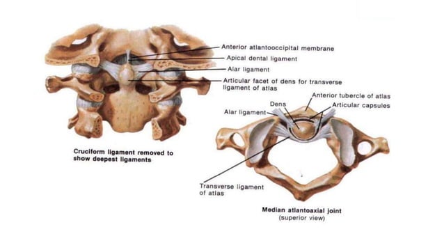 Cranio vertebral junction (CV Junction) - Dr Sameep Koshti (Consultant ...