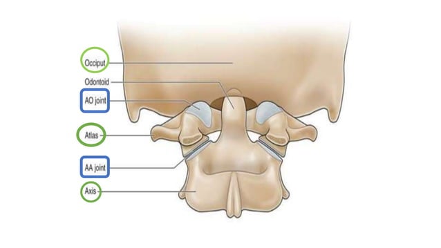 Cranio vertebral junction (CV Junction) - Dr Sameep Koshti (Consultant ...