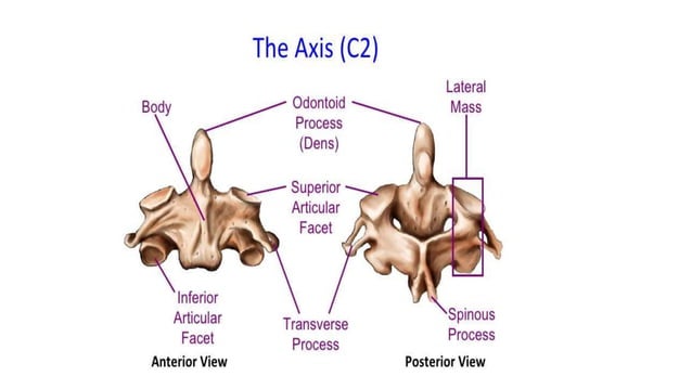 Cranio vertebral junction (CV Junction) - Dr Sameep Koshti (Consultant ...