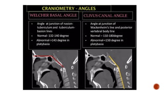 CRANIO-VERTEBRAL JUNCTION (CVJ) LINES-ANGLES | PPTX
