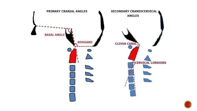 CRANIO-VERTEBRAL JUNCTION (CVJ) LINES-ANGLES | PPTX