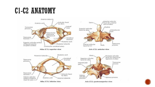 CRANIO-VERTEBRAL JUNCTION (CVJ) LINES-ANGLES | PPTX