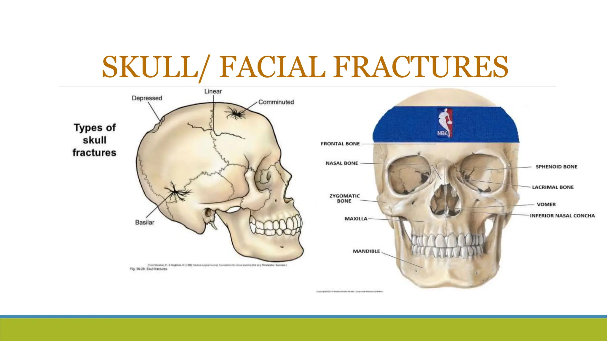 CRANIO – CEREBRAL INJURIES.pptx